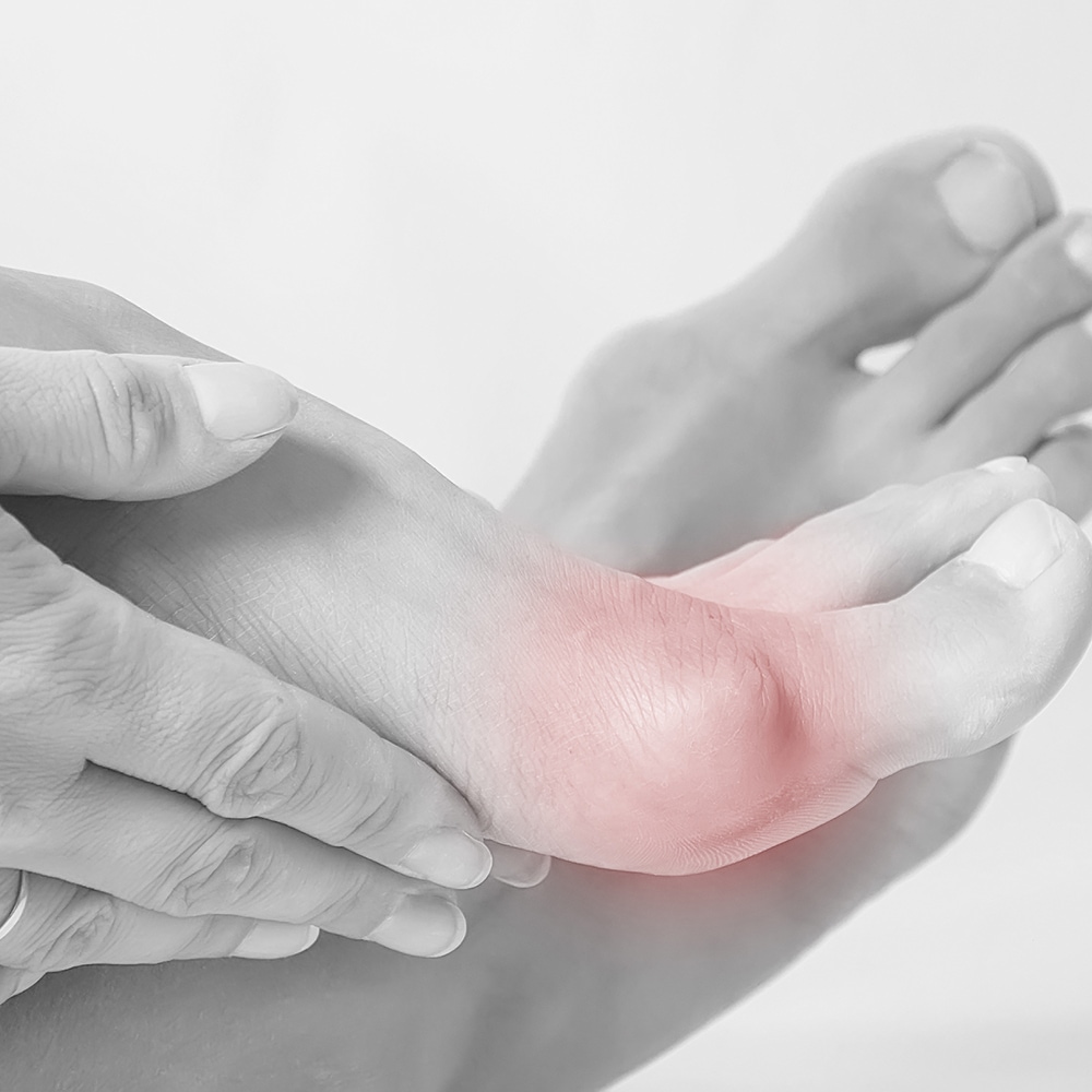 Fußgut Hallux-Pflegebalsam 100 ml | sanpura.de